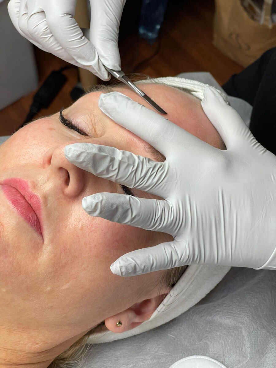 Dermaplaning - powderbrowsandlashes.com.au